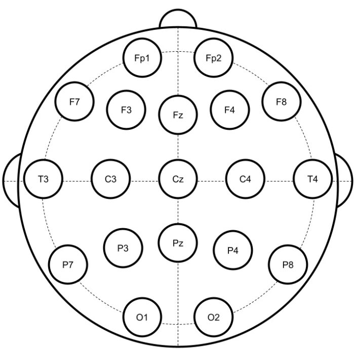 EEG (Electroencephalography) - BrainAccess