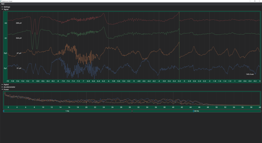 BrainAccess Board - BrainAccess