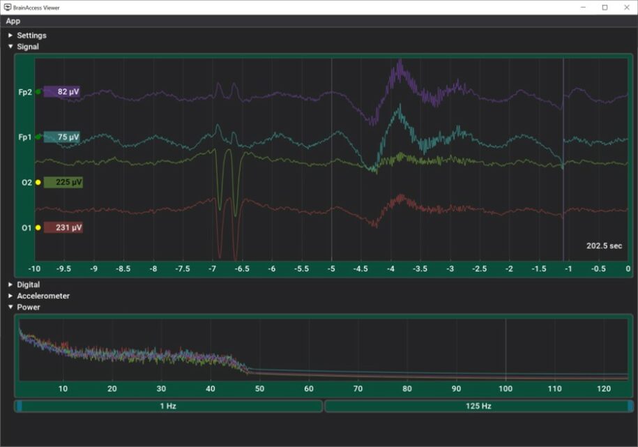 EEG Signal Quality - BrainAccess