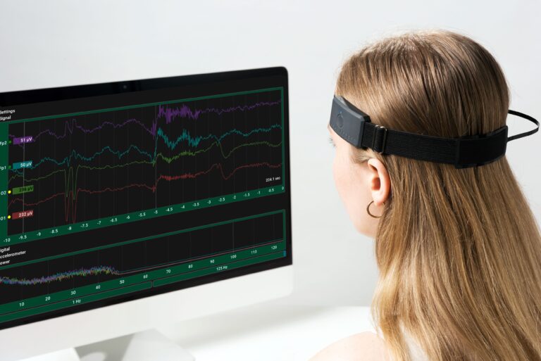 100 years of Electroencephalography