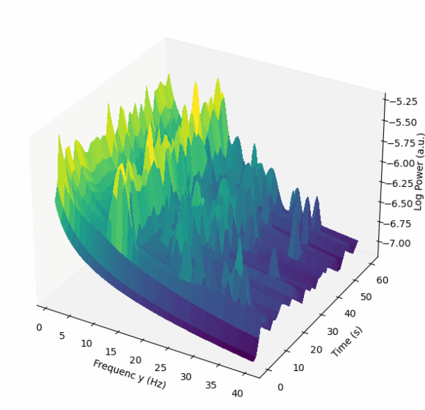 Understanding EEG Power: Beyond the Brainwaves - BrainAccess