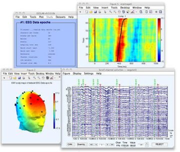 Open-Source EEG Analysis Tools: Making Brain Research More Accessible - BrainAccess